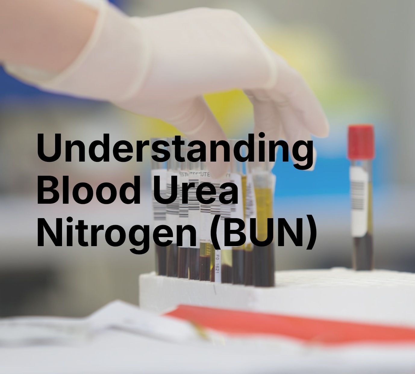 eBook: Understanding Blood Urea Nitrogen (BUN) - Renes Care